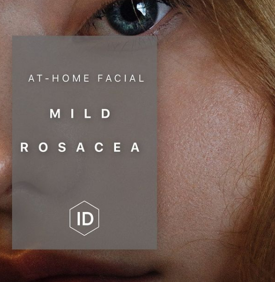 MILD ROSACEA – Institute of Dermatologists