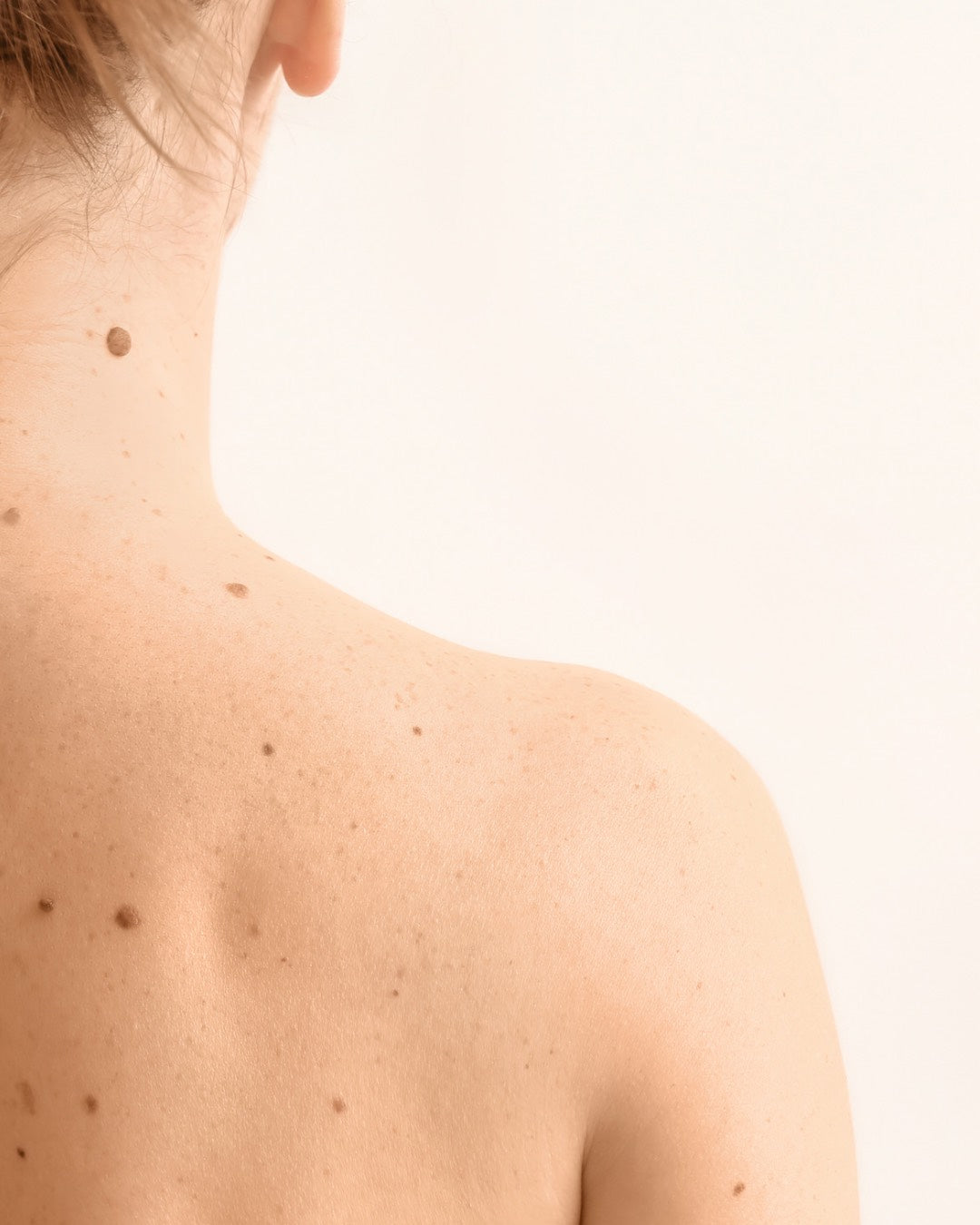 Skin Cancer Awareness | Tips for Sun Protection in Ireland – Institute ...