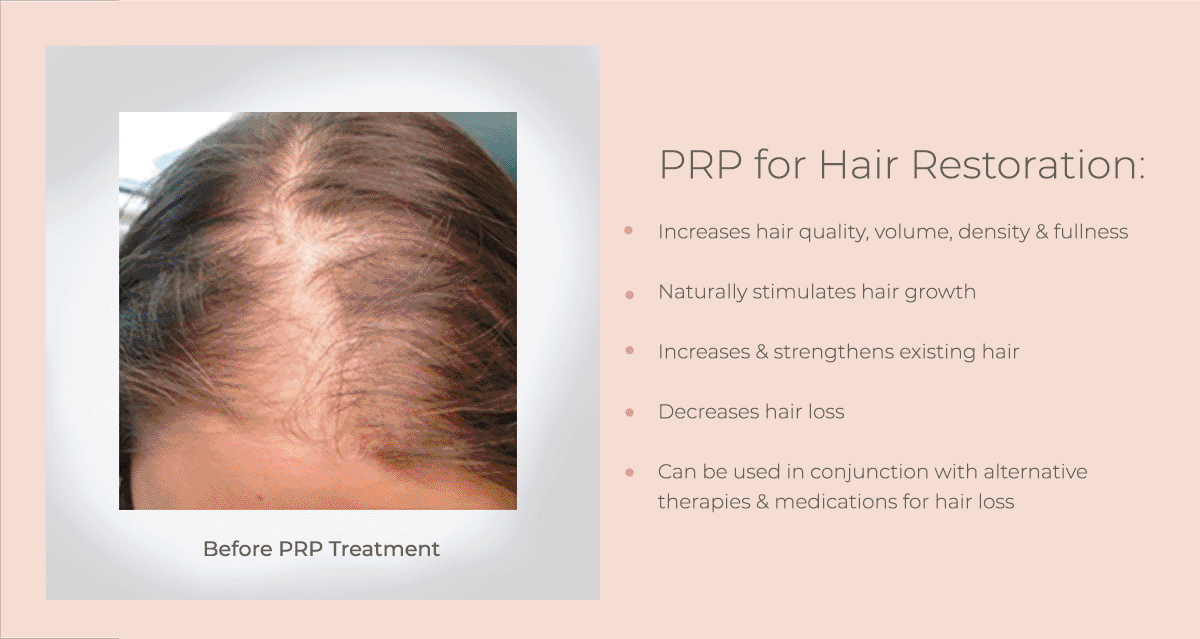 Platelet Rich Plasma PRP | Institute of Dermatologists